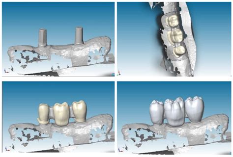 Cad Project Of Frameworks Different Wall Thicknesses Were Designed For Download Scientific