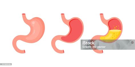 건강하고 건강에 해롭고 비어 있고 완전한 인간의 위장 내부 장기 해부학 내부 장기 인간 위장관 내부 소화 시스템의 기관 플랫 스타일의 벡터 그림 위에 대한 스톡 벡터 아트