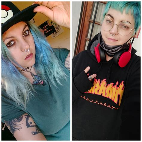 5 Years Apart Ftm Non Binary 10 Days Post Mastectomy On Right Not 5 Years Apart Ftm Non Binary 10 Days Post Mastectomy On Right Not