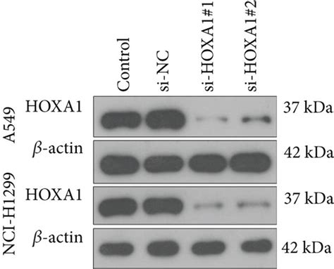 analysis of chemosensitivity signaling pathways and clone formation download scientific