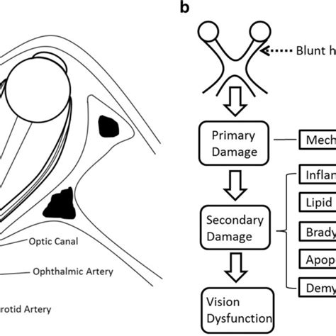 Endoscopic Views Via Etocd During Optic Canal Decompression A The