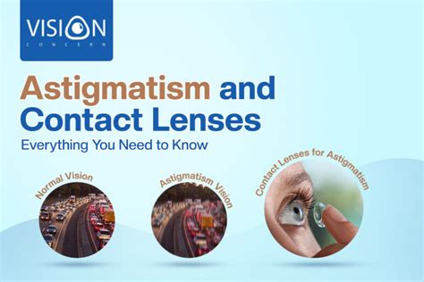 Right Contacts For Astigmatism Types Fitting And Guide