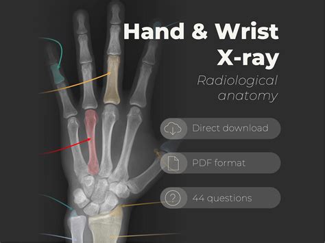 X Ray Of Hand And Wrist