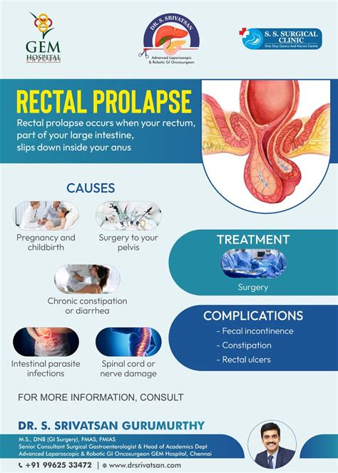 Rectal Prolapse Dr S Srivatsan Gurumurthy Medium
