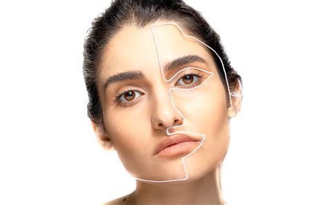 Pdo Threads Ascent Laser Aesthetics