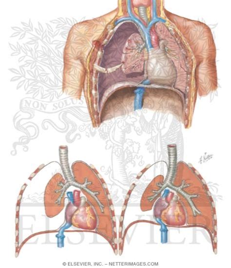 Pathogenesis Of Pneumothorax Pathophysiology Of Open Pneumothorax