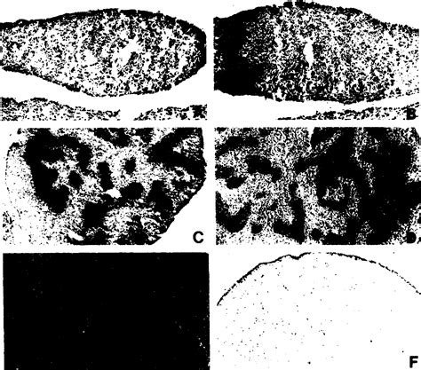 Mullerian Duct Regression Semantic Scholar