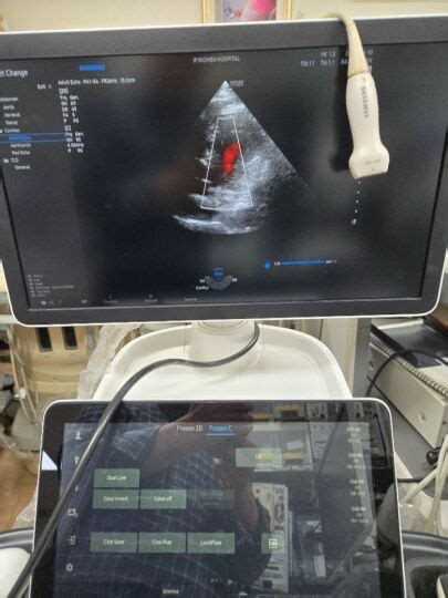 Used Samsung Pa1 5a Ultrasound Transducer For Sale Dotmed Listing