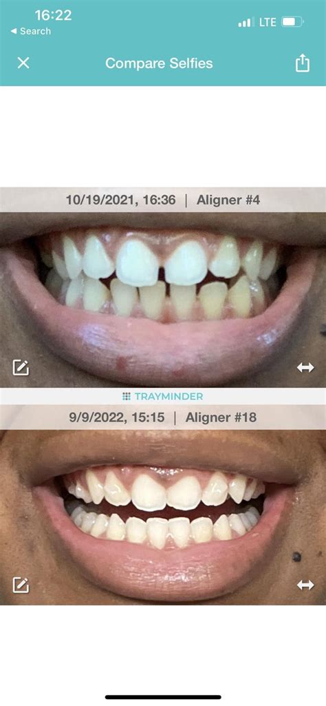 My Progress So Far Rpenspinning My Progress So Far Rpenspinning