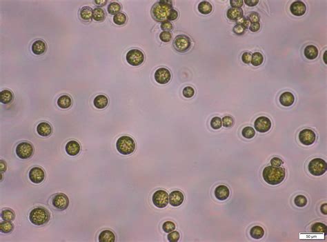 Please Can Anyone Identify This Algae In My Picture Researchgate