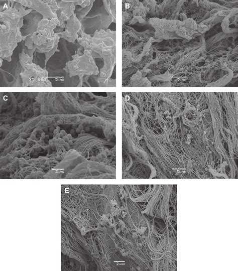 Scanning Electron Micrographs Sem Showing Presence Of Bacterial Download Scientific Diagram