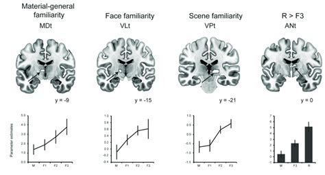 Familiarity And Recollection Effects In The Thalamus The Mdt Download Scientific Diagram