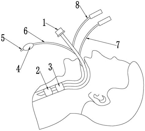 人工气道的制作方法