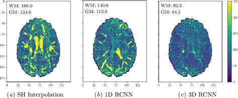 figure b 1 from angular super resolution in diffusion mri with a 3d recurrent convolutional