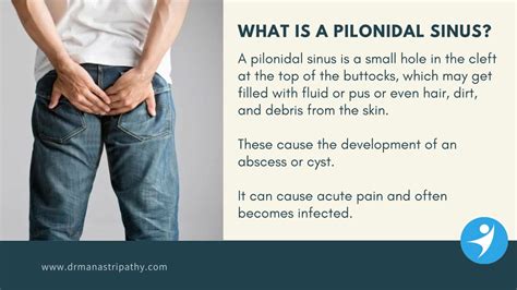 Ppt Pilonidal Sinus Causes Diagnosis Treatment Presentation