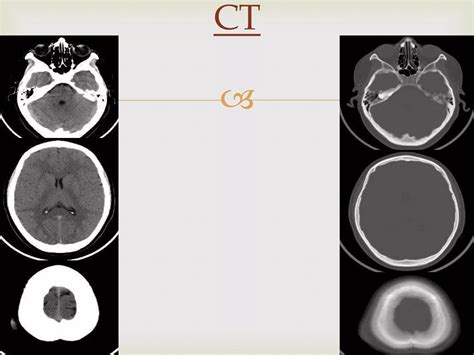 Neuro Radiology Neuroimaging Pptx
