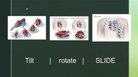 Echocardiography Pptx DATA ECHO BELAJAR ECHO PPTX Heart And Cardiovascular Diseases