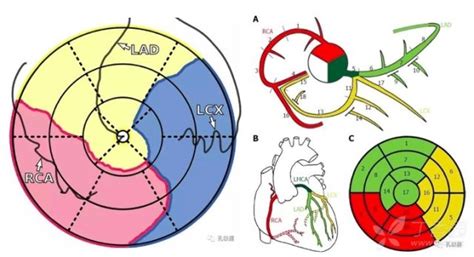 「前间壁心肌梗死」：是否该废除这个诊断名词？ 丁香园