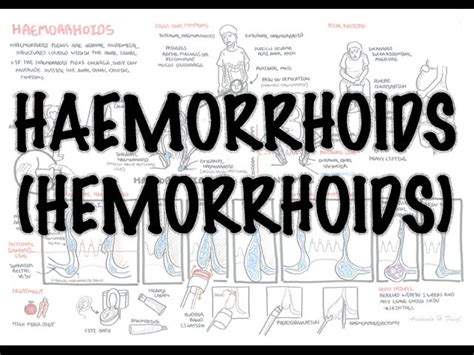 Haemorrhoids Hemorrhoids Overview Pathophysiology Investigations