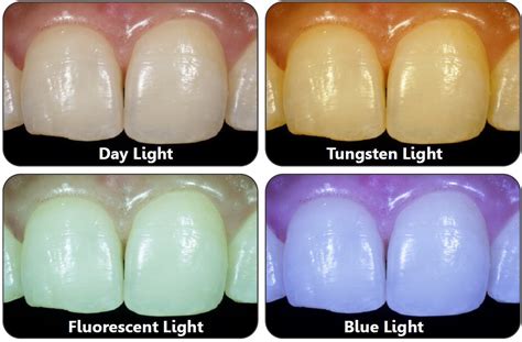 Online Open Access Dental Magazine Journal Publication Dentistry Journal