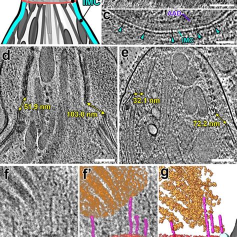 The Protruded Conoid Is Tilted And Off Center Relative To The Aprs A