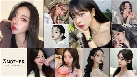 어나더성형외과