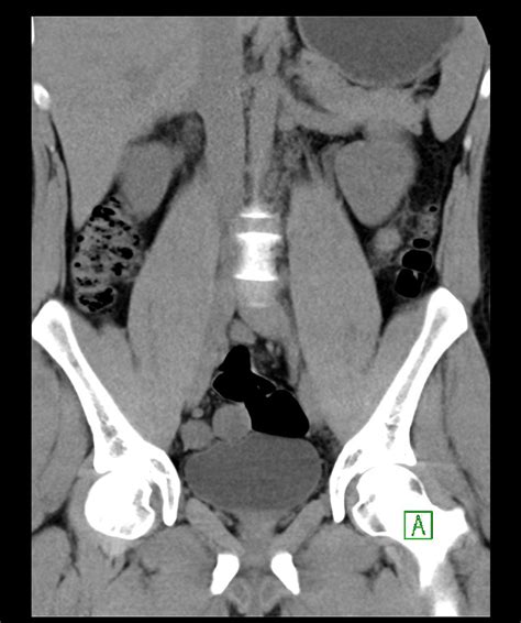 Image Radiopaedia Org