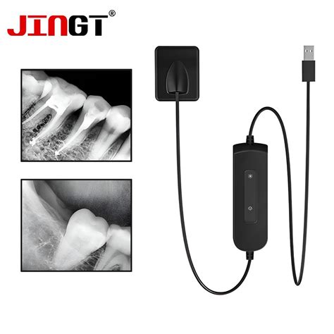 Jingt Dental Sensor X Ray High Frequency Rx Digital Intraoral Digital System H D Image