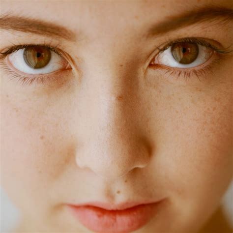 Roaccutane Package باقة تحاليل الروكتان Tlc Kuwait