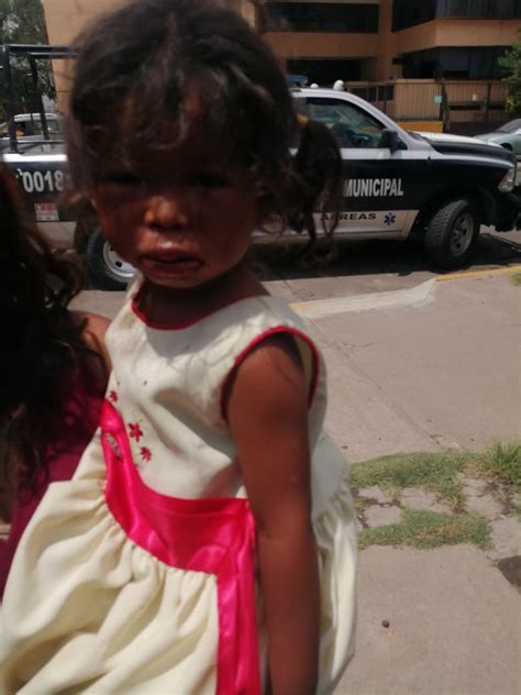 Fotos Niña De 2 Años Es Golpeada Brutalmente Por Su Padrastro Diario1