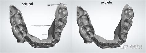 3shape 模型扫描仪 知乎