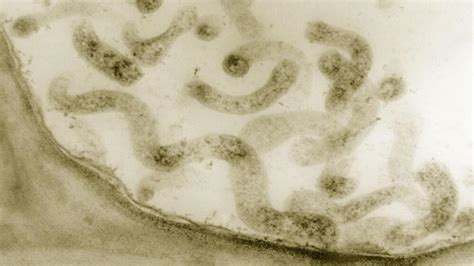 The Worlds Smallest Life Form Can Now Move Thanks To Genetic Engineering Lifeboat News The Blog