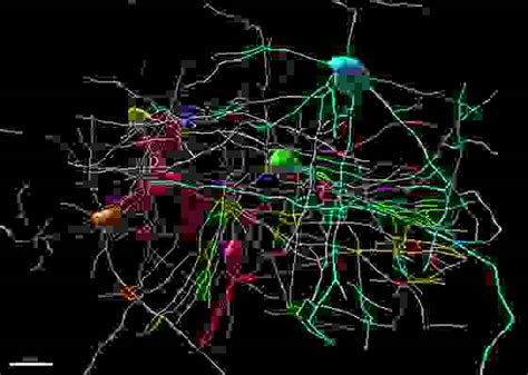 imaris 10 0 microscopy image analysis with ai filament tracer