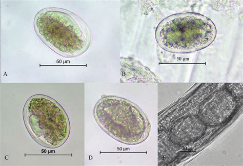Micrographs Of Eggs Of The Nematodes From Serra Da Capivara National