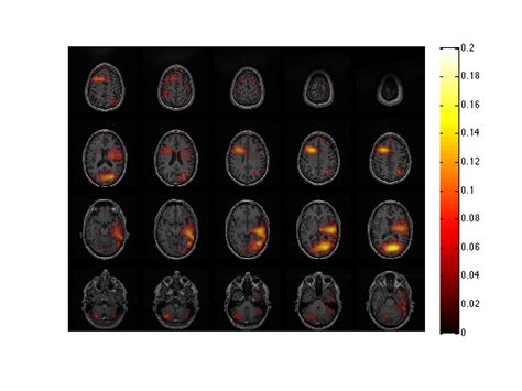 Meg Beamforming The Best Picture Of Beam