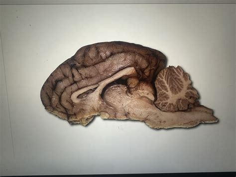Sheep Brain Model 1 Diagram Quizlet