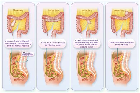 Sigmoid Colon Relations