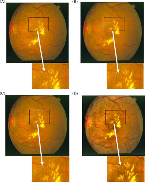 Enhanced Output Of The Algorithm With A Respective Enlarged Portion A