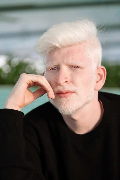 Premium Photo Portrait Of An Albino Man Looking In The Camera
