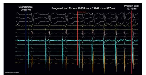 Figure 1 From Automatic Algorithmic Driven Monitoring Of