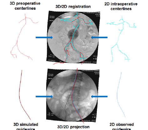 Feature Based 3d 2d Registration The 3d 2d Transformation Is Estimated