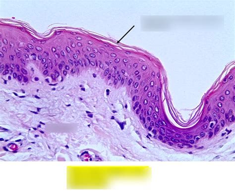 Stratified Squamous Keratinized Epithelium 400x