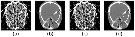 An Axial Slice Of A Reconstructed Head Cbct Volume A Under Sparse Download Scientific Diagram