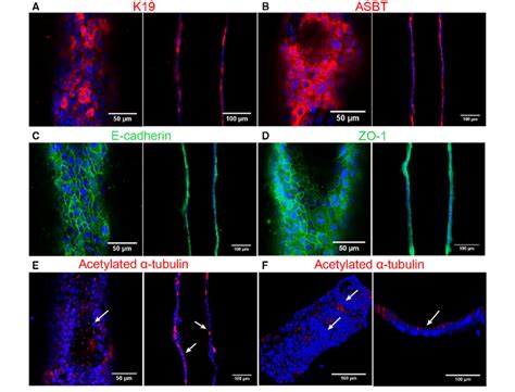 Bile Duct On A Chip With Primary Murine Extrahepatic Cholangiocytes