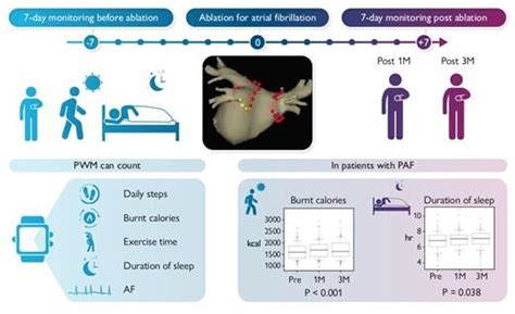 Willem Gielen Md On Linkedin Wristwatch Pulse Wave Monitoring