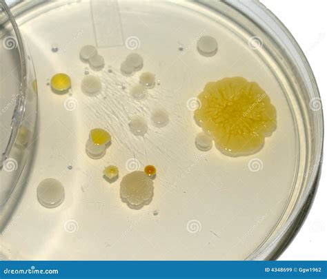 Bacterial Colonies Stock Image Image Of Morphology Science 4348699