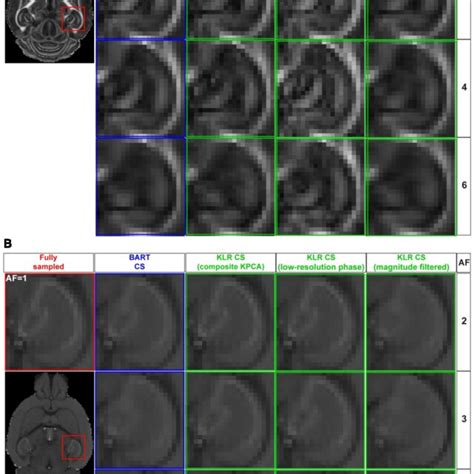 Fa And Md Maps From Fully Sampled Data And After Simulated Download Scientific Diagram