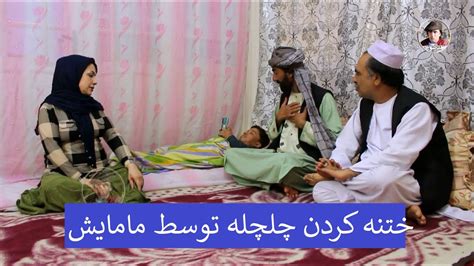 ختنه کردن چلچله توسط مامایش Youtube