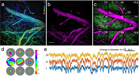 brain imaging system uses ‘multi pupil prism arrays purdue