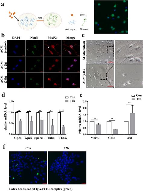 Ucb Induced Astrocytes Attenuated Normal Astrocytic Function A